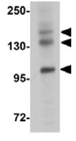 Anti-PRDM16 Antibody | ABD130